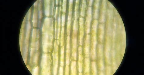 Pbi 2010 Unesa Plasmolysis