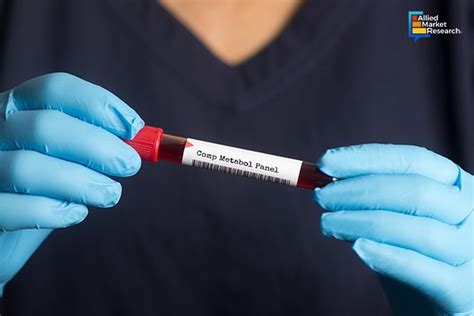 How Are CMP Testing Assisting In Diagnosing And Monitoring Various Health Conditions