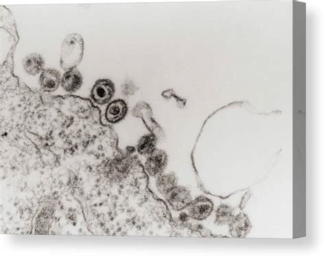 Hiv Virus Under Microscope
