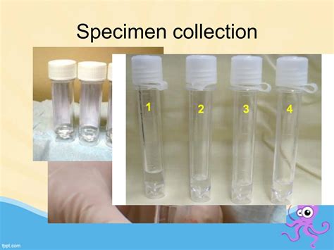 Body Fluid Analysis In Clinically Approved PDF Blood Disorders Diseases And Conditions