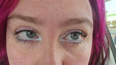 Closer Look At My Freckles R Freckledgirls