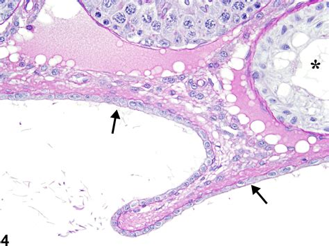 Rete Testis Histology