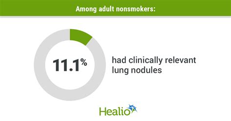 42 Of Nonsmokers Have One Or More Solid Lung Nodules