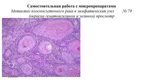 Опухоли кроветворной и лимфоидной ткани презентация онлайн