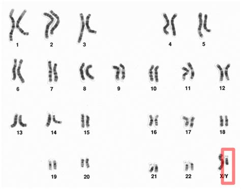 Y Chromosomes Are Shrinking So Will Men Go Extinct