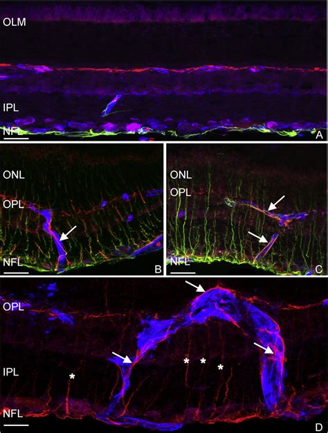 The Responses Of Astrocytes In A Rat Model Of Rhegmatogenous Retinal Download Scientific