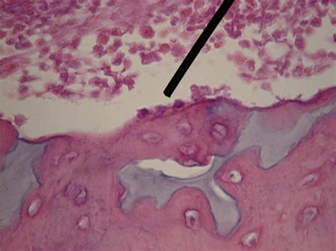 Osteoblasts Bone