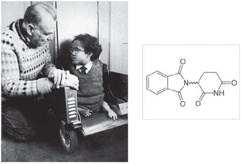 8 Un Enfant Atteint De Phocomélie Due Au Thalidomide Download