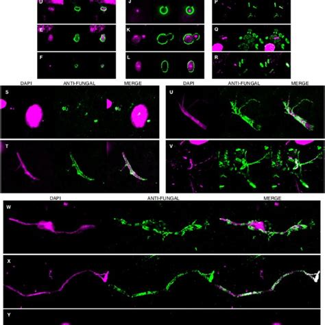 DAPI Staining Of Nuclei Of The Different Fungal Morphologies DAPI Download Scientific Diagram