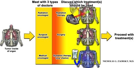 Different Types Of Radiation Therapy For Cancer All About Radiation