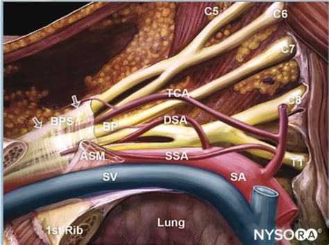 Intercostobrachial Nerve Block