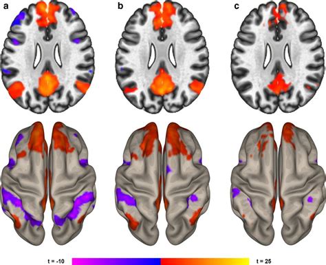 Resting State Connectivity Between Mpfc Seed And The Rest Of The Brain Download Scientific