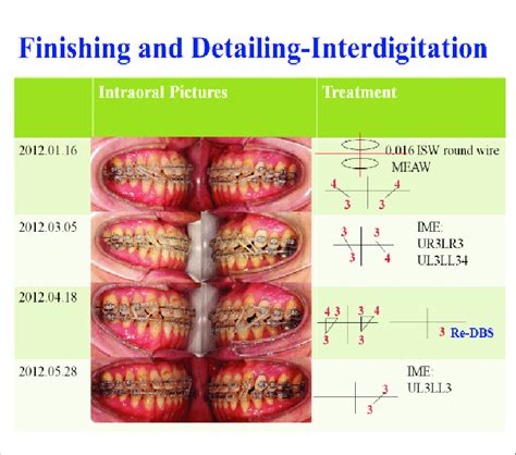 Process Of Finishing And Detailing Interdigitation Download Scientific Diagram