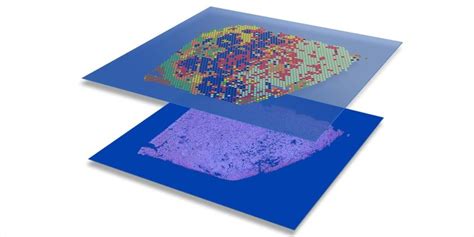 Research Sphere Reports On Linkedin Spatialtranscriptomics Genomics