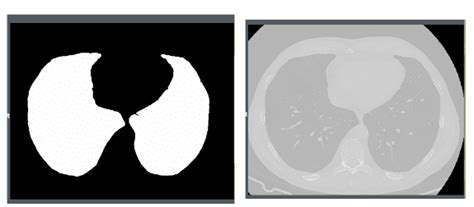 Introduction To Medical Image Processing With Python Ct 40 Off