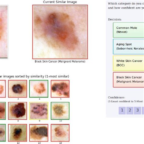 Sample Screenshot With Cbir Algorithm Results Download Scientific Diagram