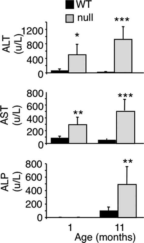 A Critical Role For Ceramide Synthase 2 In Liver Homeostasis Ii