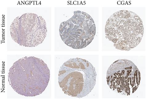 Genomic Mutation Profiles Of Different Risk Groups And Genes A Download Scientific Diagram