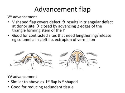 Ppt Cummings Chap 24 Reconstruction Of Facial Defects Powerpoint Presentation Id 2982802