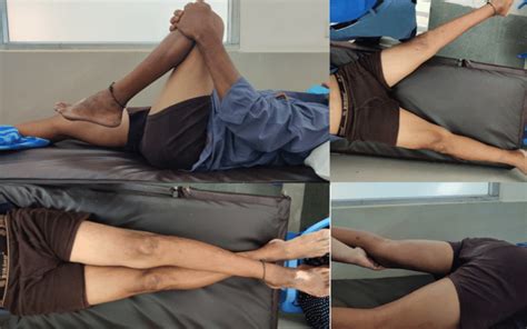 Functional Outcome Assessment Done At 5 Years Follow Up Download Scientific Diagram