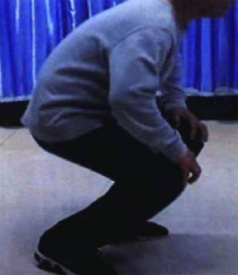 Preoperative Squatting Position Download Scientific Diagram