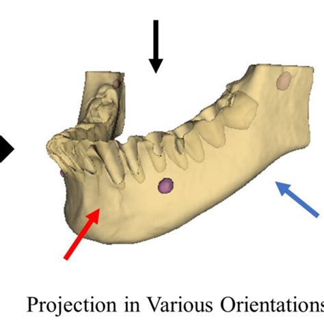 Illustration Of Mandibular Centerline Extraction Download Scientific Diagram