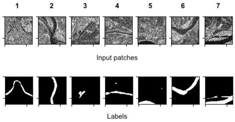 Sample Input Patches Vh And Labels Download Scientific Diagram