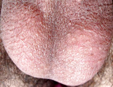 Ah Queue Coucou Porn Pictures Xxx Photos Sex Images 2114876 Pictoa Ah Queue Coucou Porn Pictures Xxx Photos Sex Images 2114876 Pictoa