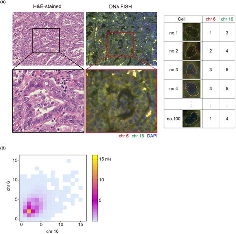 Fluorescence In Situ Hybridization‐based Assessment Of Ploidy Of Tumor