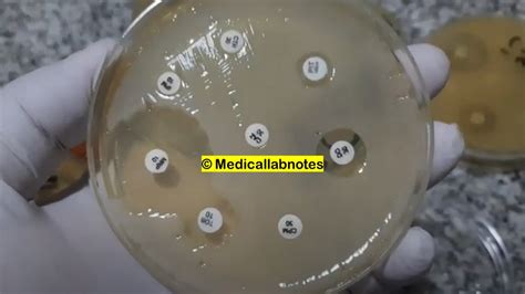 Acinetobacter Introduction Morphology Pathogenicity Lab