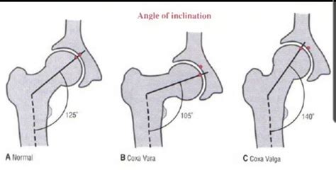 척추ㆍ근골격계환우모임 기공심리운동교정요법and건강정보 Band Page