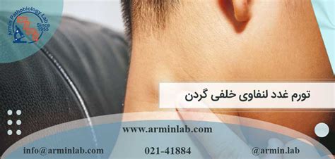 تورم غدد لنفاوی خلفی گردن آزمایشگاه آرمین بیماری های گوارشی