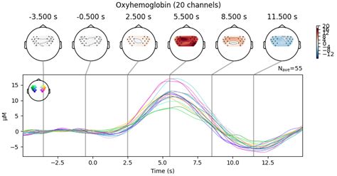 Preprocessing Functional Near Infrared Spectroscopy Fnirs Data — Mne 180 Documentation