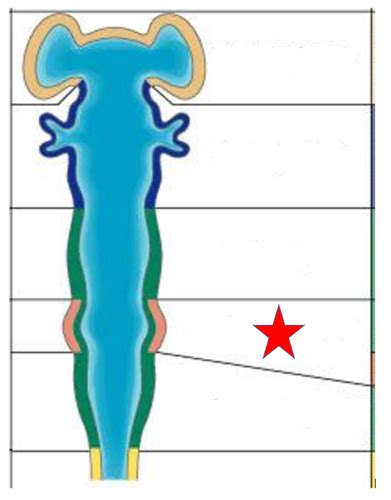 Lecture 6 Structures Of The Hindbrain Flashcards Quizlet