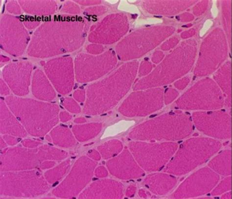 Sarcoplasm Histology