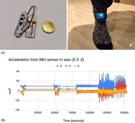1 A Low Cost Noninvasive Inertial Sensor That Can Be Attached To