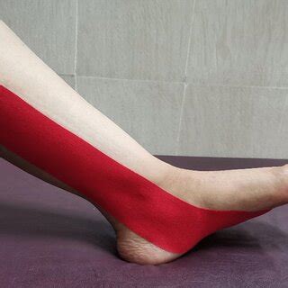 Tibialis Posterior Kinesio Taping Download Scientific Diagram
