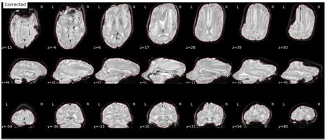 Fmriprep Output Distortion Correction And Bold Mask Neurostars