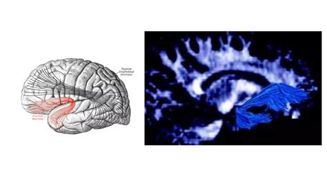 Diffusion Tensor Imaging Pptx