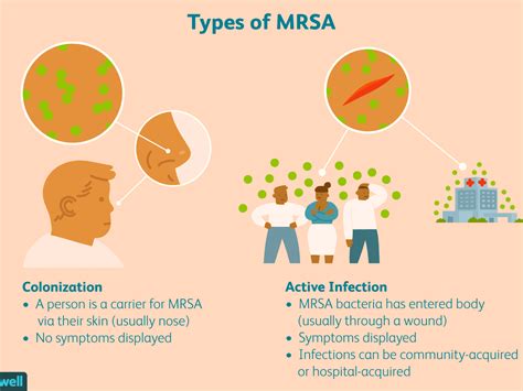How To Diagnose Mrsa Possibilityobligation5
