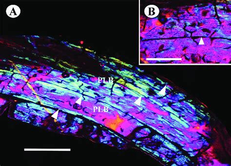 bone histology of the left femur of mariliasuchus amarali mpm 082 a