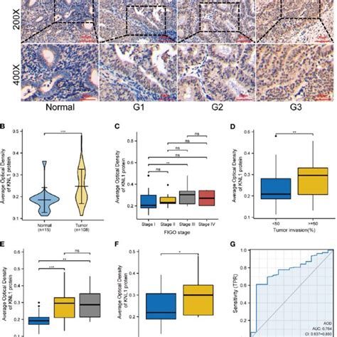 Expression And Clinical Correlation Analysis Of Knl1 In Ucec Clinical Download Scientific