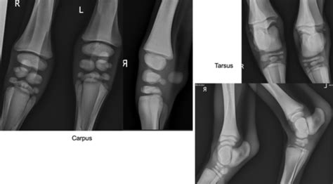 Neonatal Angular Limb Deformity Flashcards Quizlet