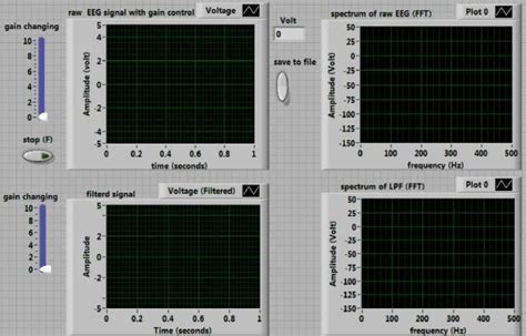 10 Eeg Plotter Control And Display Panel On A Computer Download