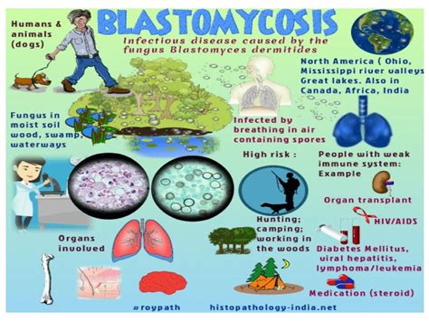 A Comprehensive Ppt On Blastomycosis Pptx