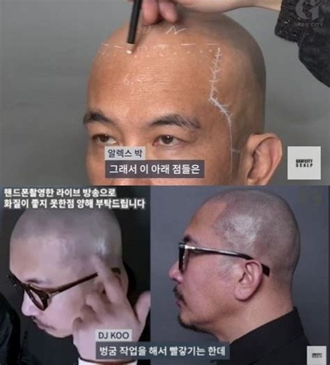 구준엽 대머리 문신 홍석천 이하늘도 추천 네이트 연예