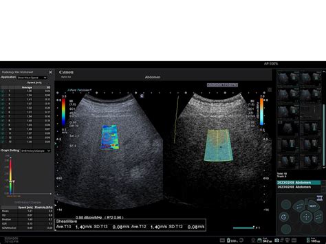 超音波診断装置 Aplio Me｜epicus Club｜キヤノンメディカルシステムズ株式会社