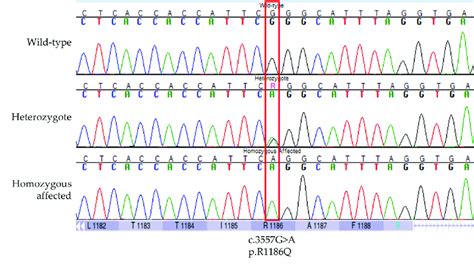Representative Sanger Sequencing Electropherograms For Wild Type