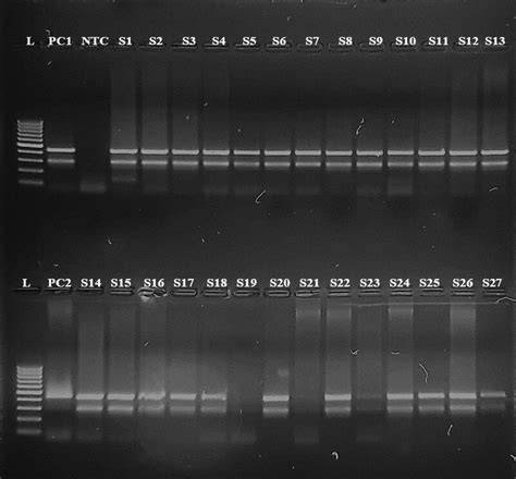Visualization Of Results Of Multiplex Polymerase Chain Reaction One Download Scientific Diagram