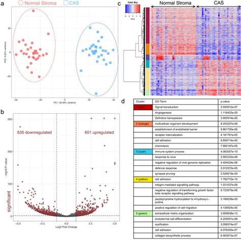 Transcriptomic Profiling Of Matched Cas And Normal Stroma From 31